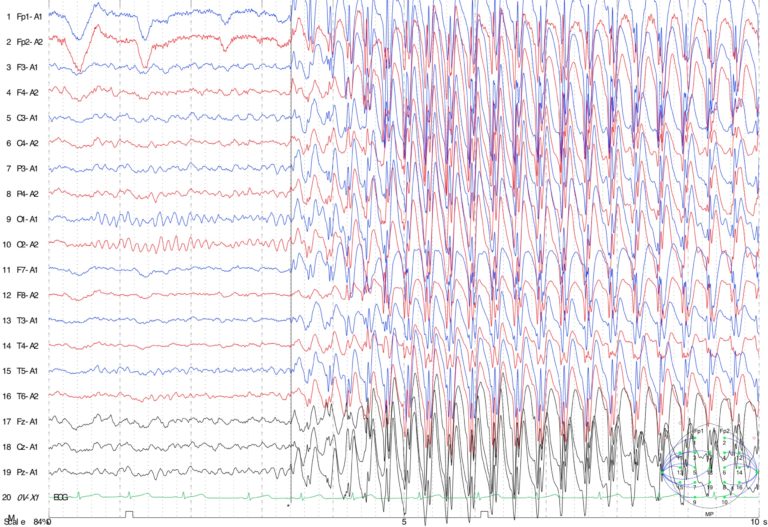 脳波検査 | 医療法人社団かけはし